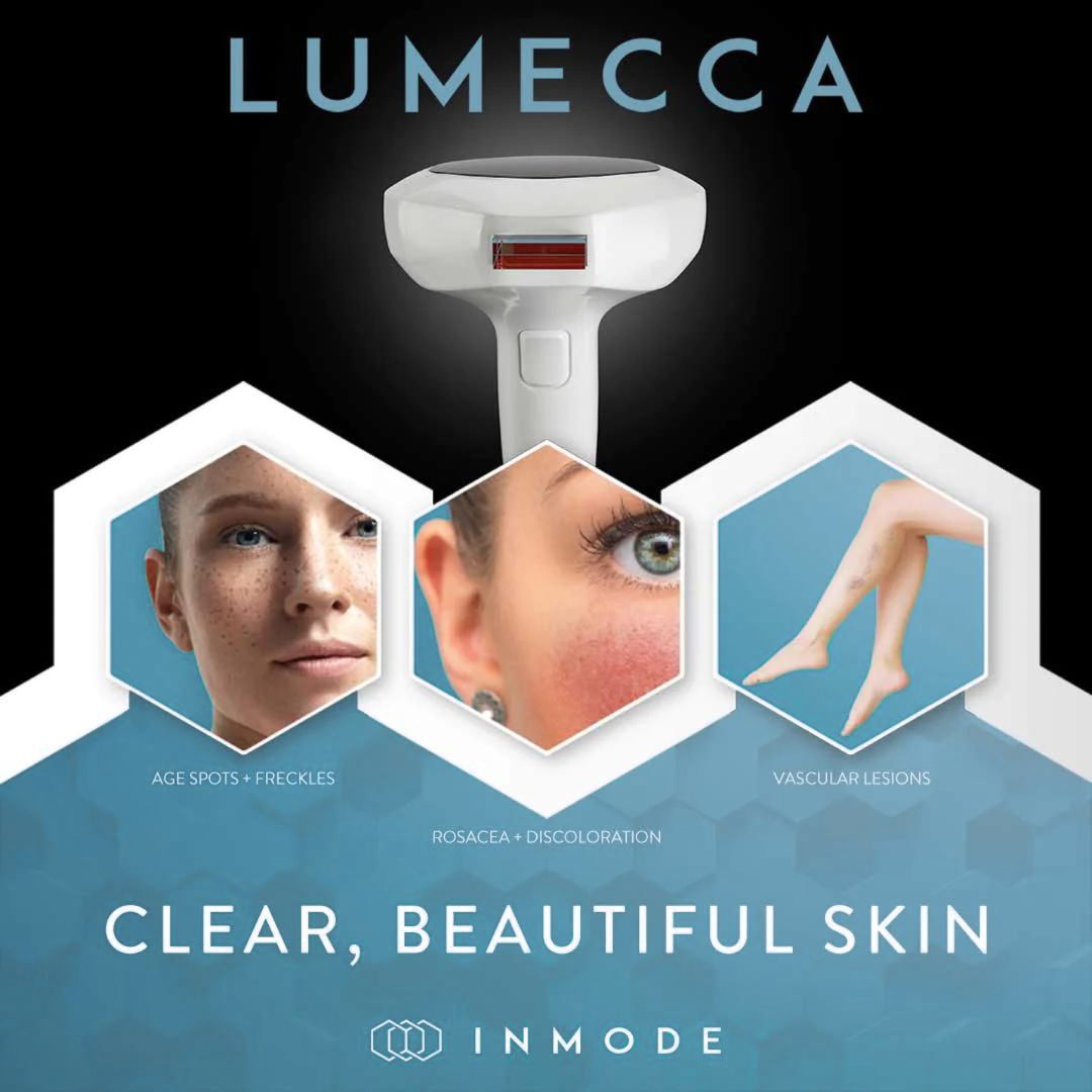 IPL Photofacial - Intense Pulse Light Treatment - Blue Ridge Dermatology