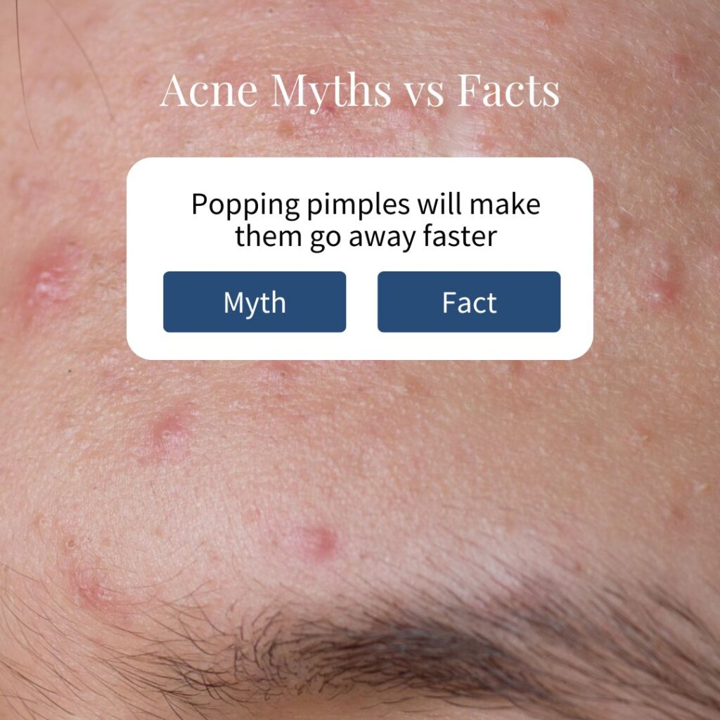 Myths vs. Facts About Acne - Blue Ridge Dermatology